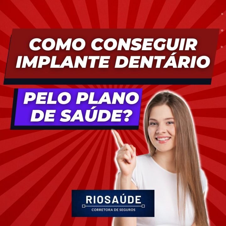 Como Conseguir Implante Dentário Pelo Plano De Saúde